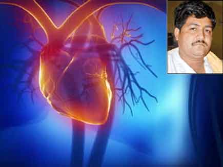 जन्‍म के 32 साल बाद पता चला दिल और जिगर उल्‍टी तरफ हैं