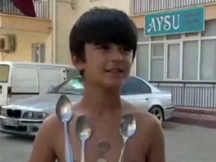 यकीन कीजिए! तुर्की में रहता है 'मैग्नेटिक बॉय'