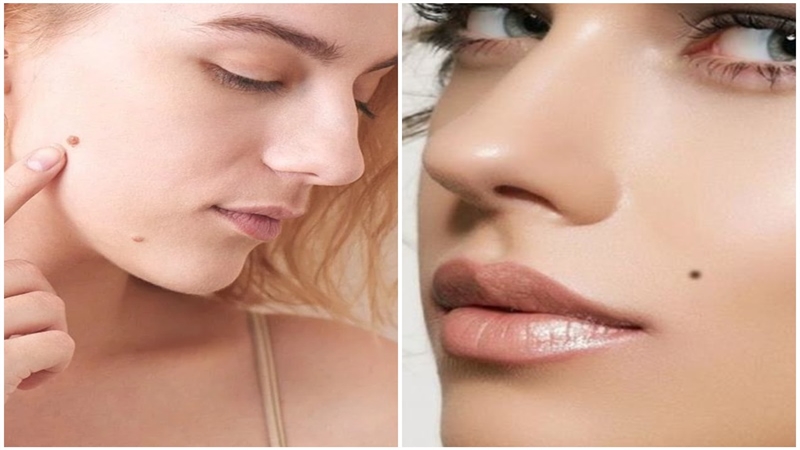 Mole Marks: जानिए क्या कहते हैं आपके नाक कान होंठ और चेहरे पर बने तिल ...