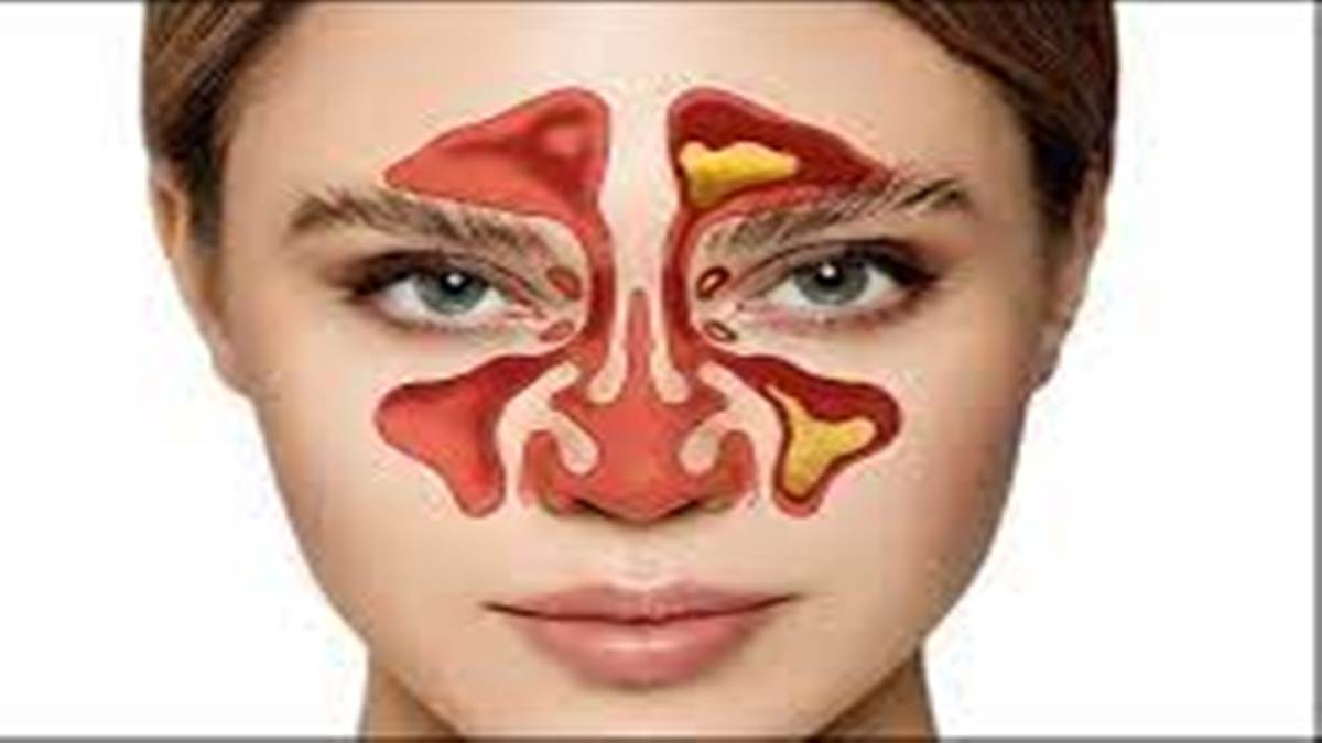 Sinus problem: साइनस की समस्या को कम करेगा नियमित योग का अभ्यास - Sinus ...