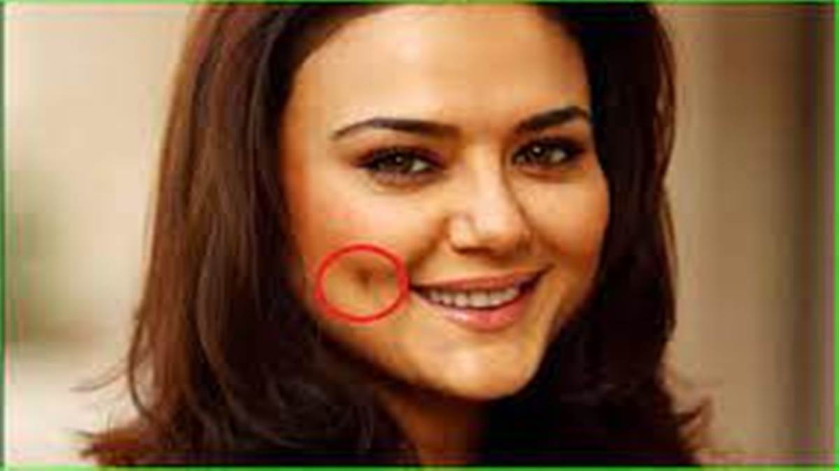 Gwalior News: गाल पर डिंपल की दीवानी युवतियां, करा रहीं सर्जरी ...